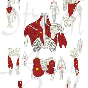 Upper Body - Trigger Point Chart - Muscle Anatomy Art - Chiropractic ...