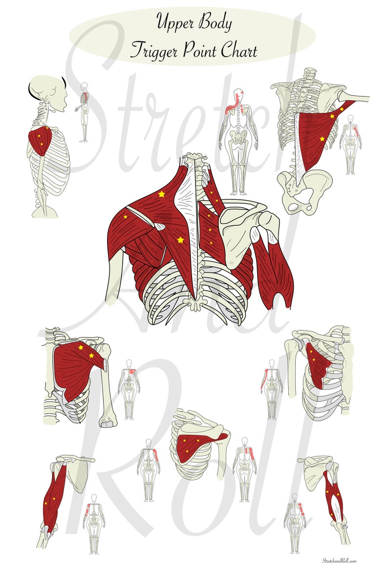 Upper Body - Trigger Point Chart - Muscle Anatomy Art - Chiropractic ...