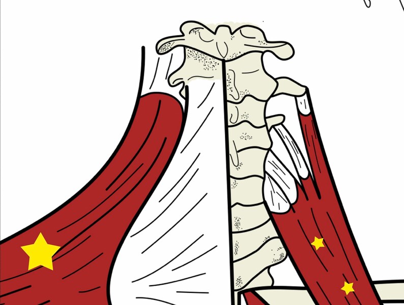 The Basics - Trigger Point Chart - Muscle Anatomy Art - Chiropractic ...