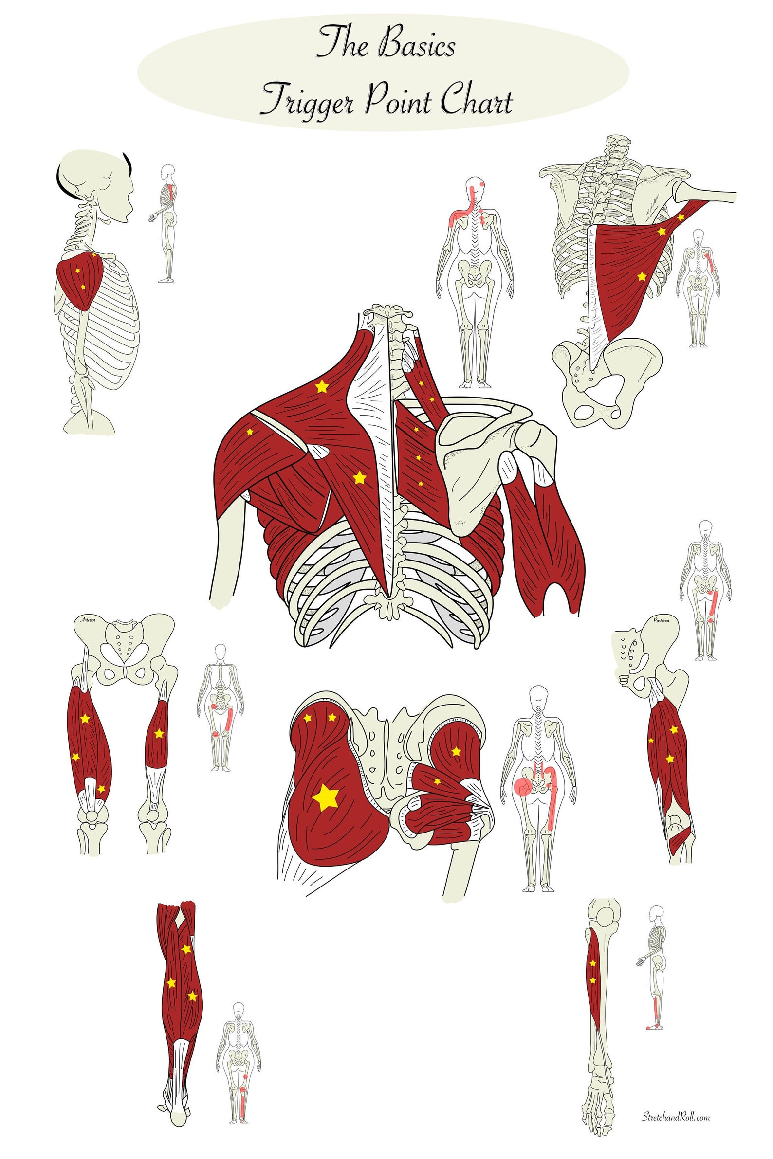 The Basics - Trigger Point Chart - Muscle Anatomy Art - Chiropractic ...