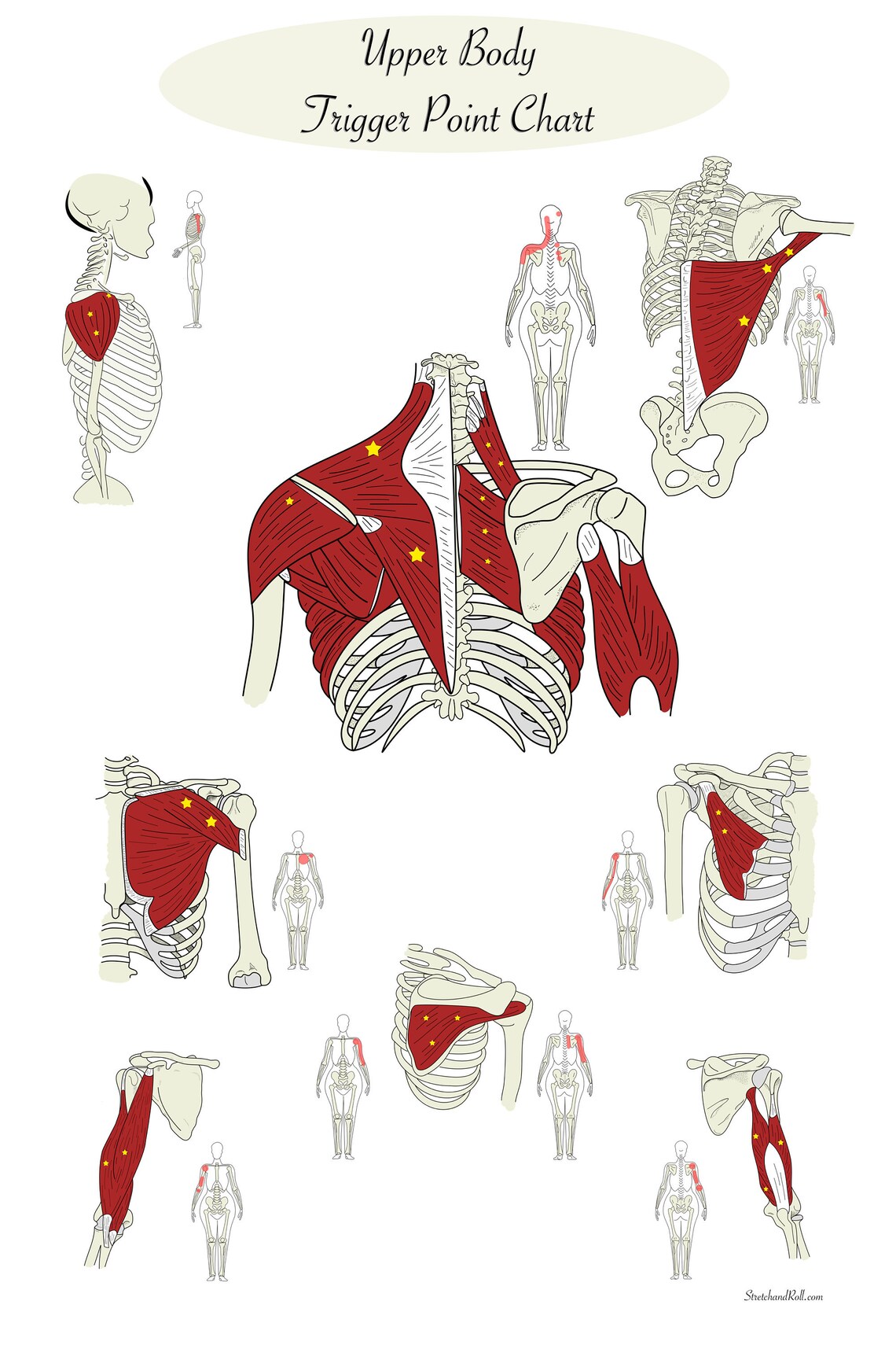 Upper Body - Trigger Point Chart - Muscle Anatomy Art - Chiropractic ...