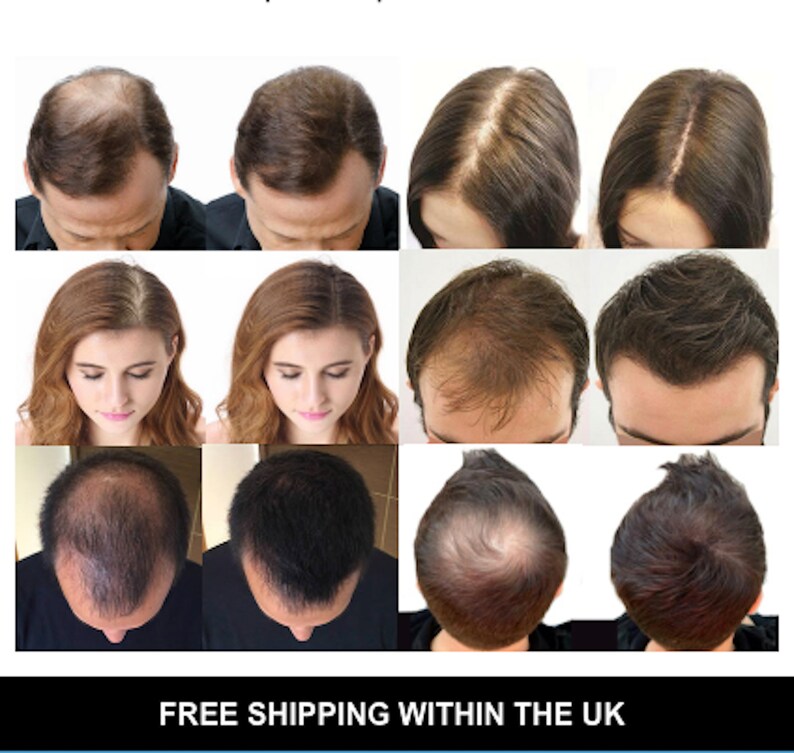 100% Natural Keratin Hair Building Fibres Refill for Hair Loss ...
