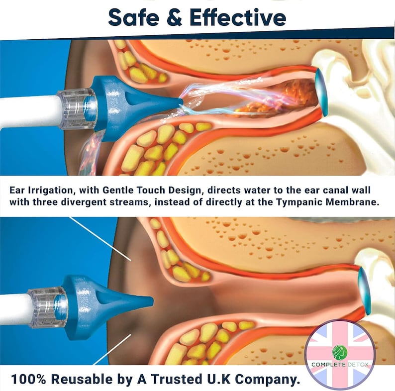 Ear Wax Remover Syringe Kit – Ear Syringe With Spiral Earwax Removal ...