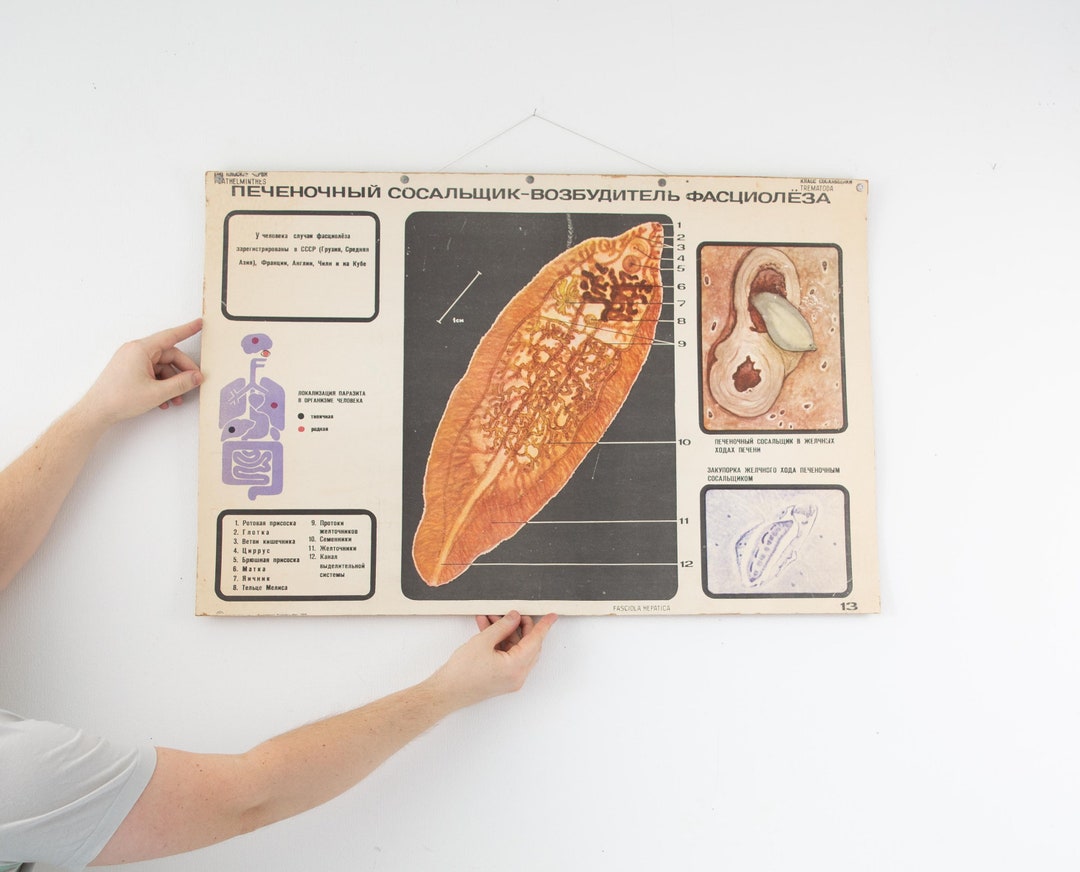 Vintage Parasites Science Poster: 1970s School Educational Chart - Etsy