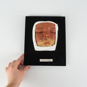 Vintage Wax Anatomical Model, Vintage Medical Moulage, Curiosities ...