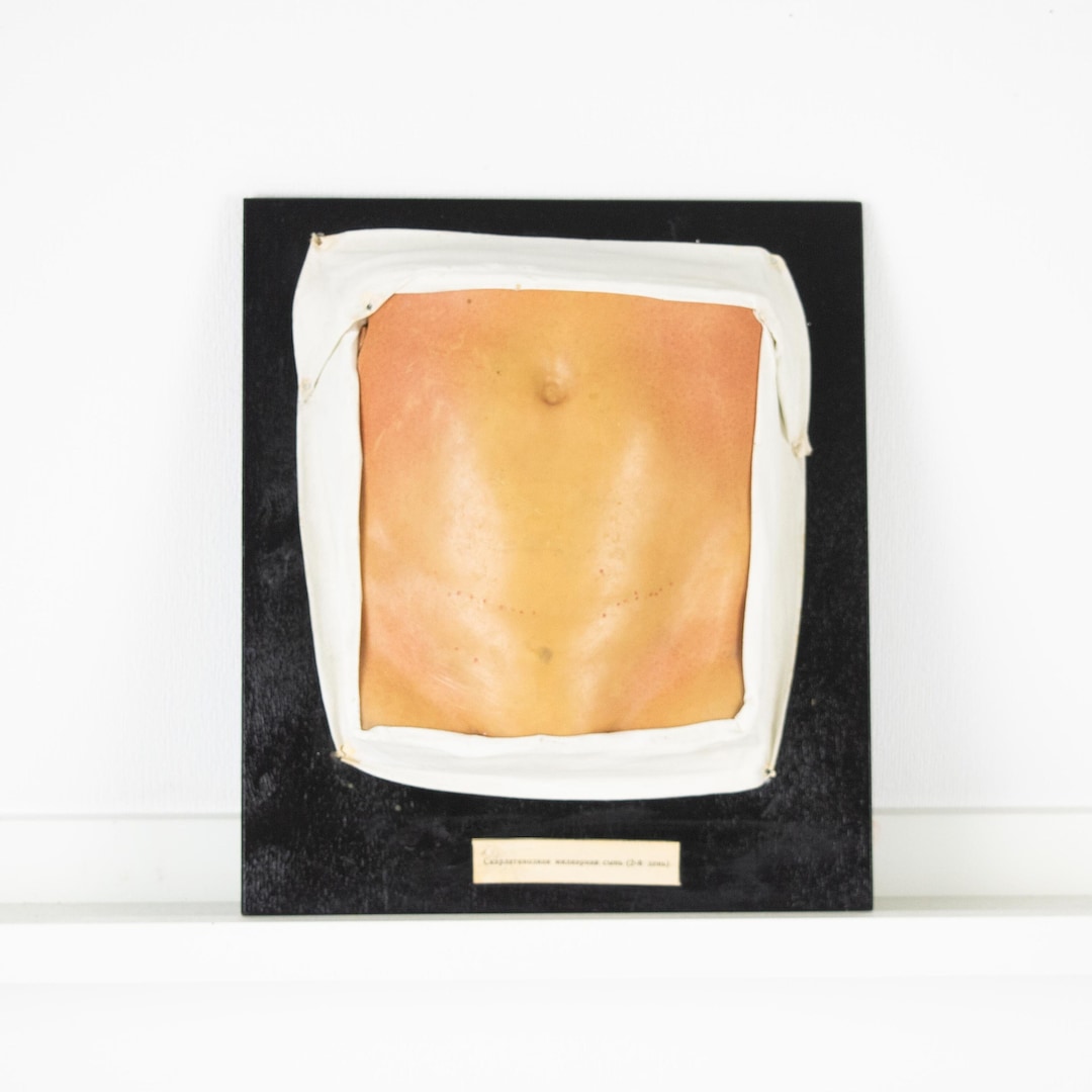 Vintage Wax Anatomical Model, Vintage Medical Model of Belly ...