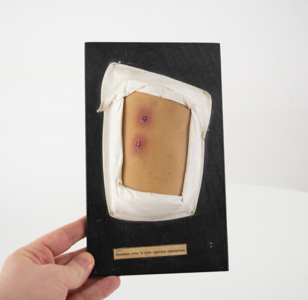 Vintage Wax Anatomical Model, Vintage Medical Model, Curiosities ...