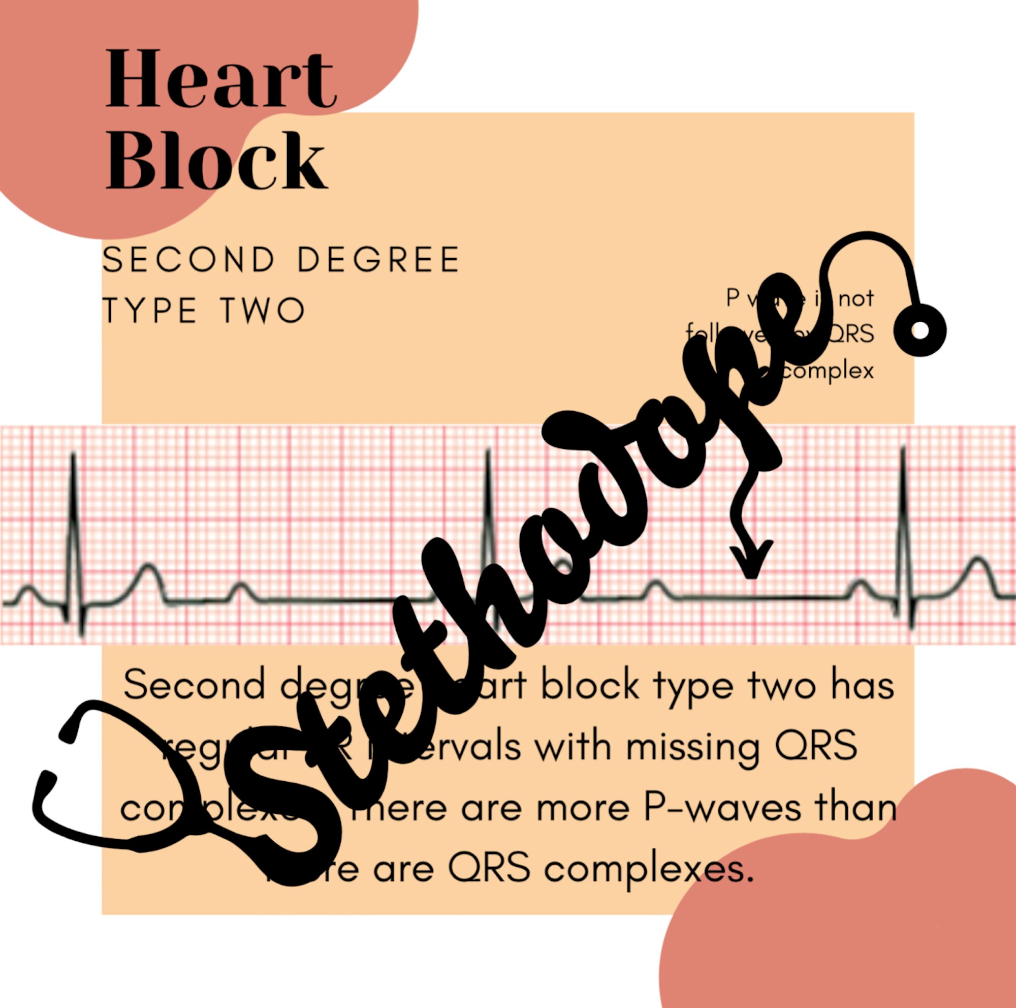 Heart Rhythm Strips Bundle - Etsy