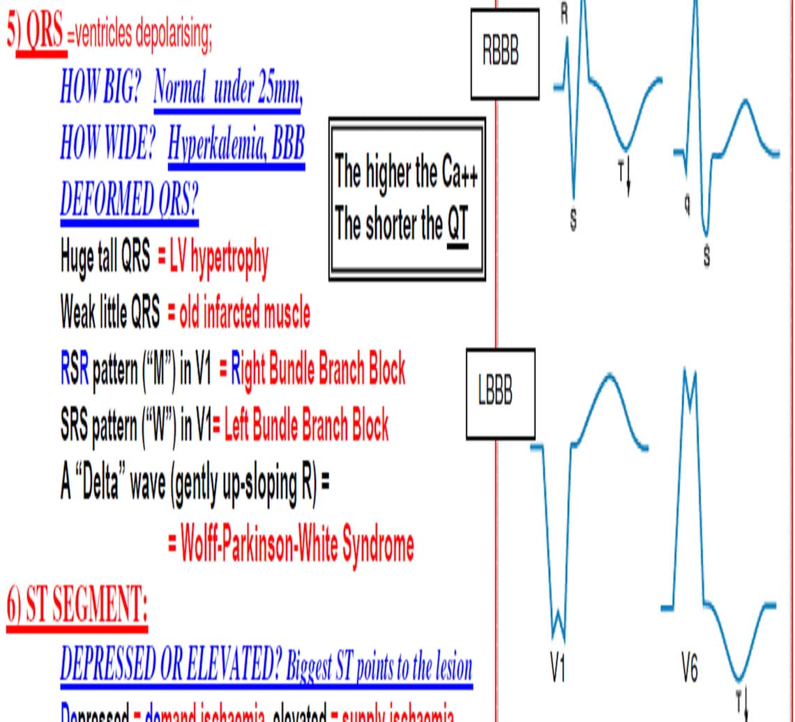 Any Nurse Must Know ECG Interpretation Cheat Sheet Made Easy - Etsy