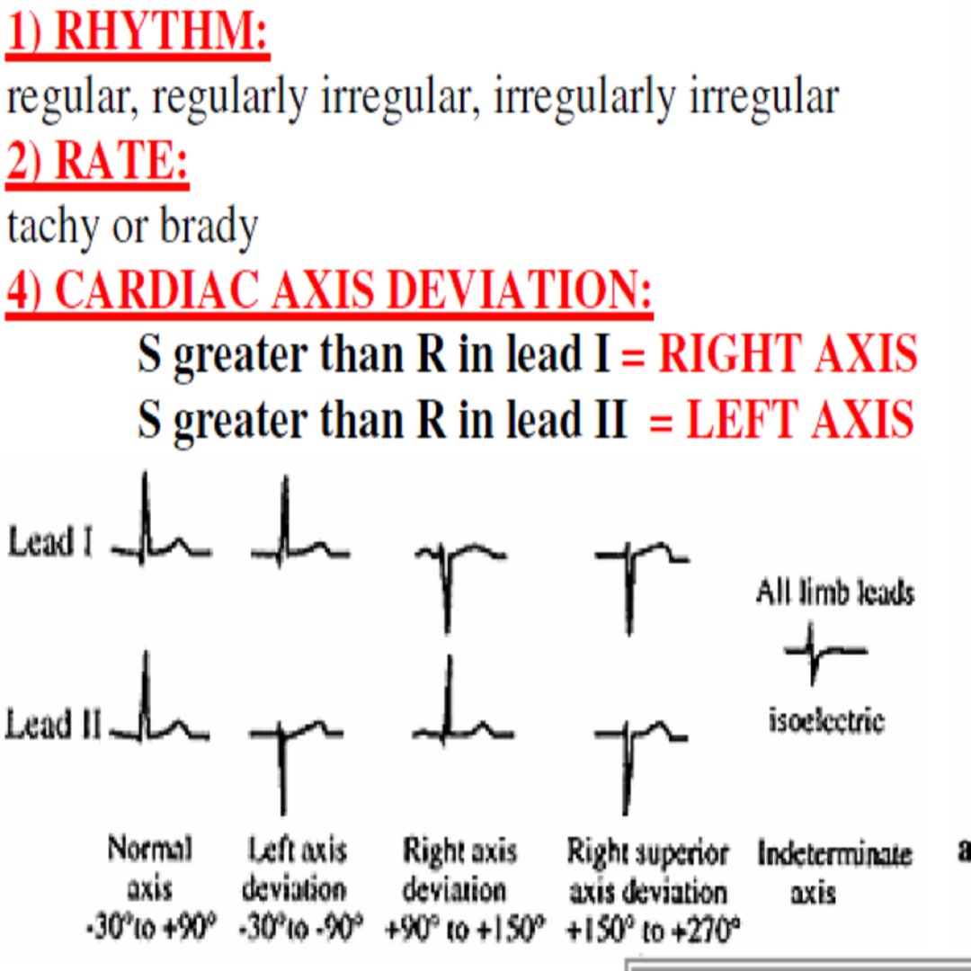 Any Nurse Must Know ECG Interpretation Cheat Sheet Made Easy - Etsy