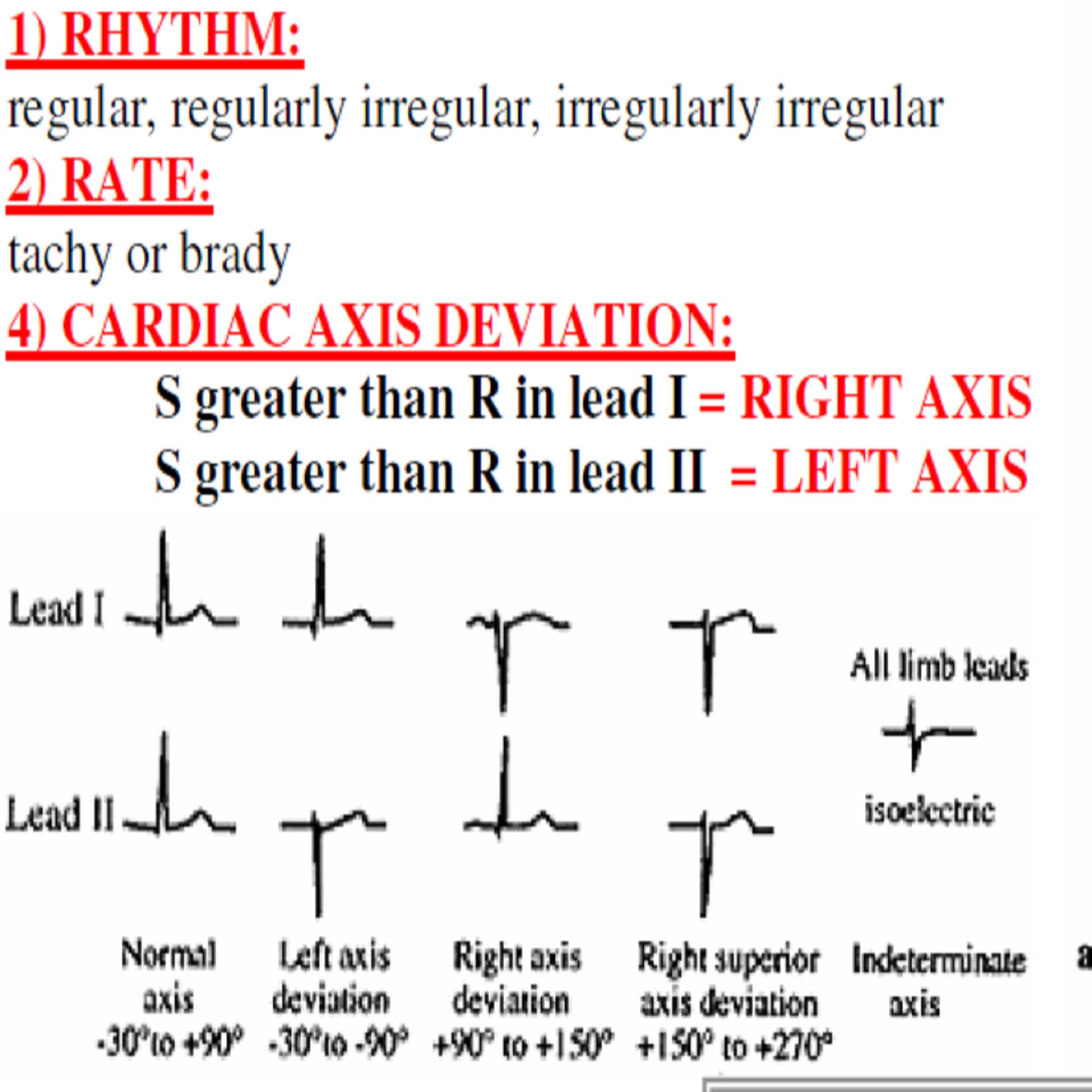 Any Nurse Must Know ECG Interpretation Cheat Sheet Made Easy - Etsy