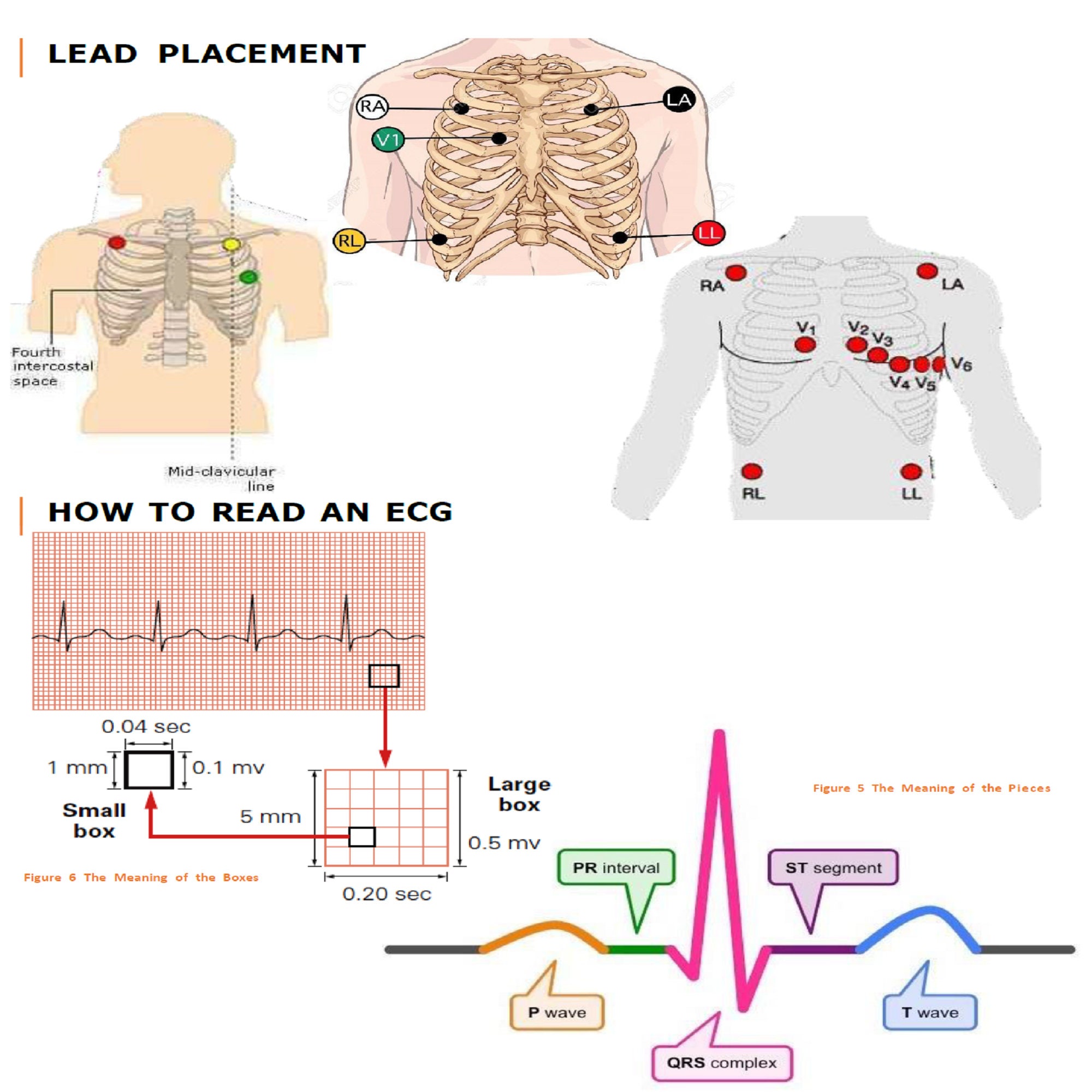 Advanced ECG for Advanced Providers Like MD, NP, Pa and Other 8 Pages ...