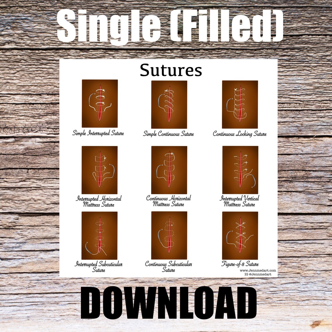 Suture Types Techniques Worksheet Single FILLED Digital Download Human ...