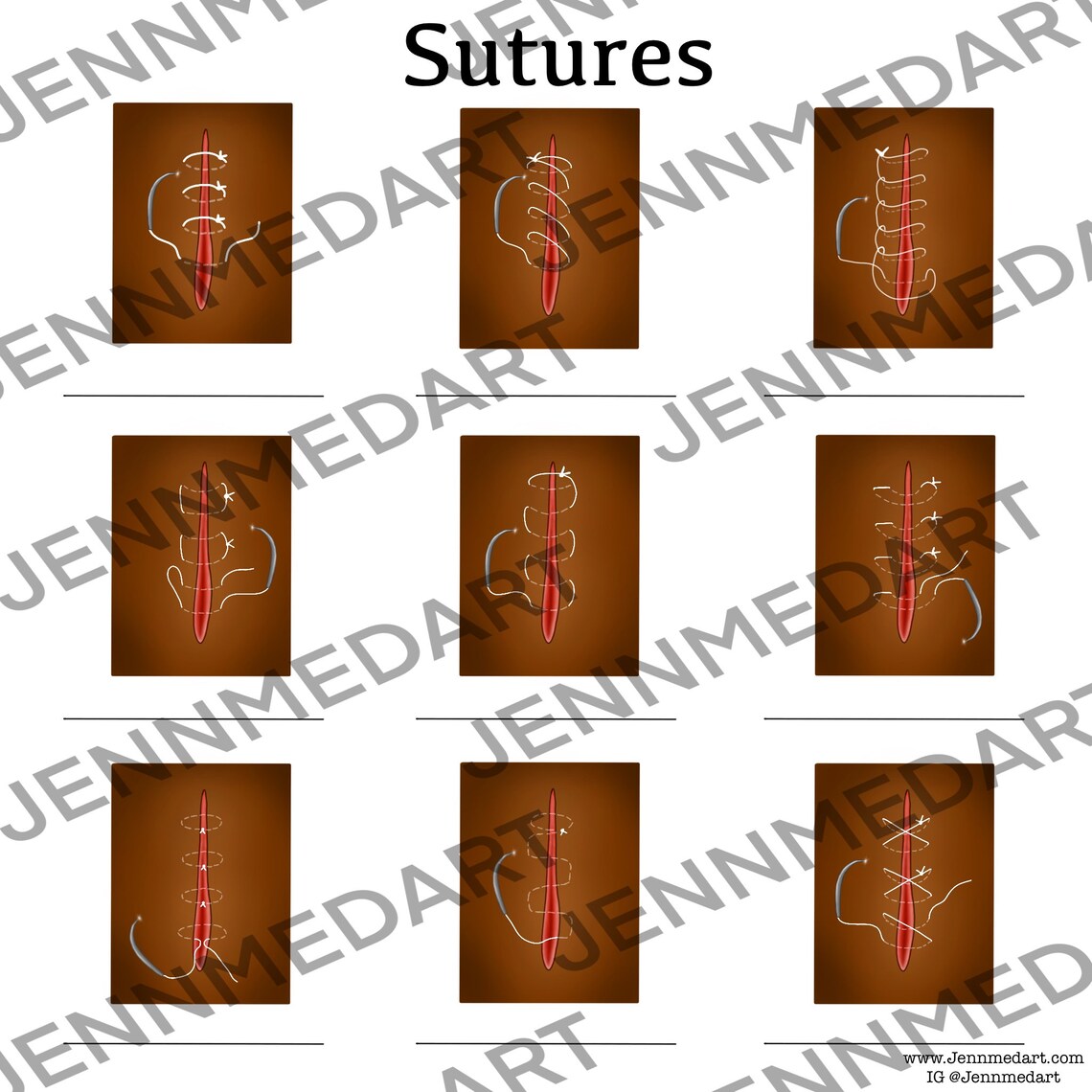 Suture Types Techniques Worksheet Single FILLABLE Digital Download ...