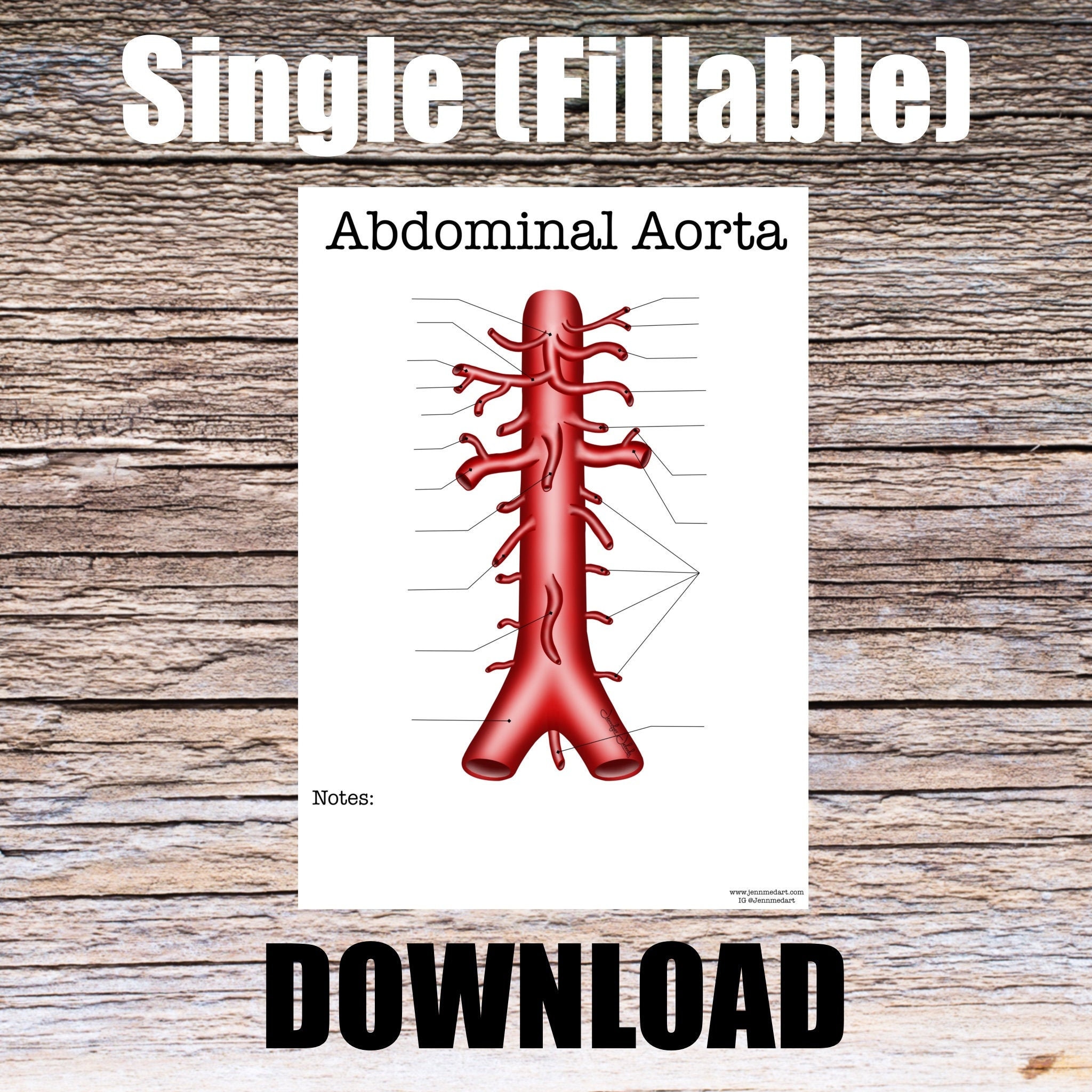 Abdominal Aorta Diagram