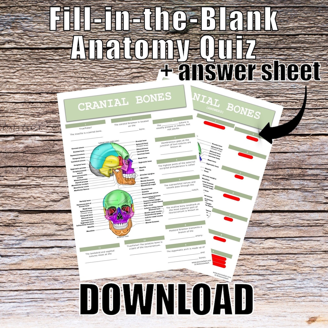 Cranial Bones Anatomy QUIZ Worksheet + Answers - Digital Download ...