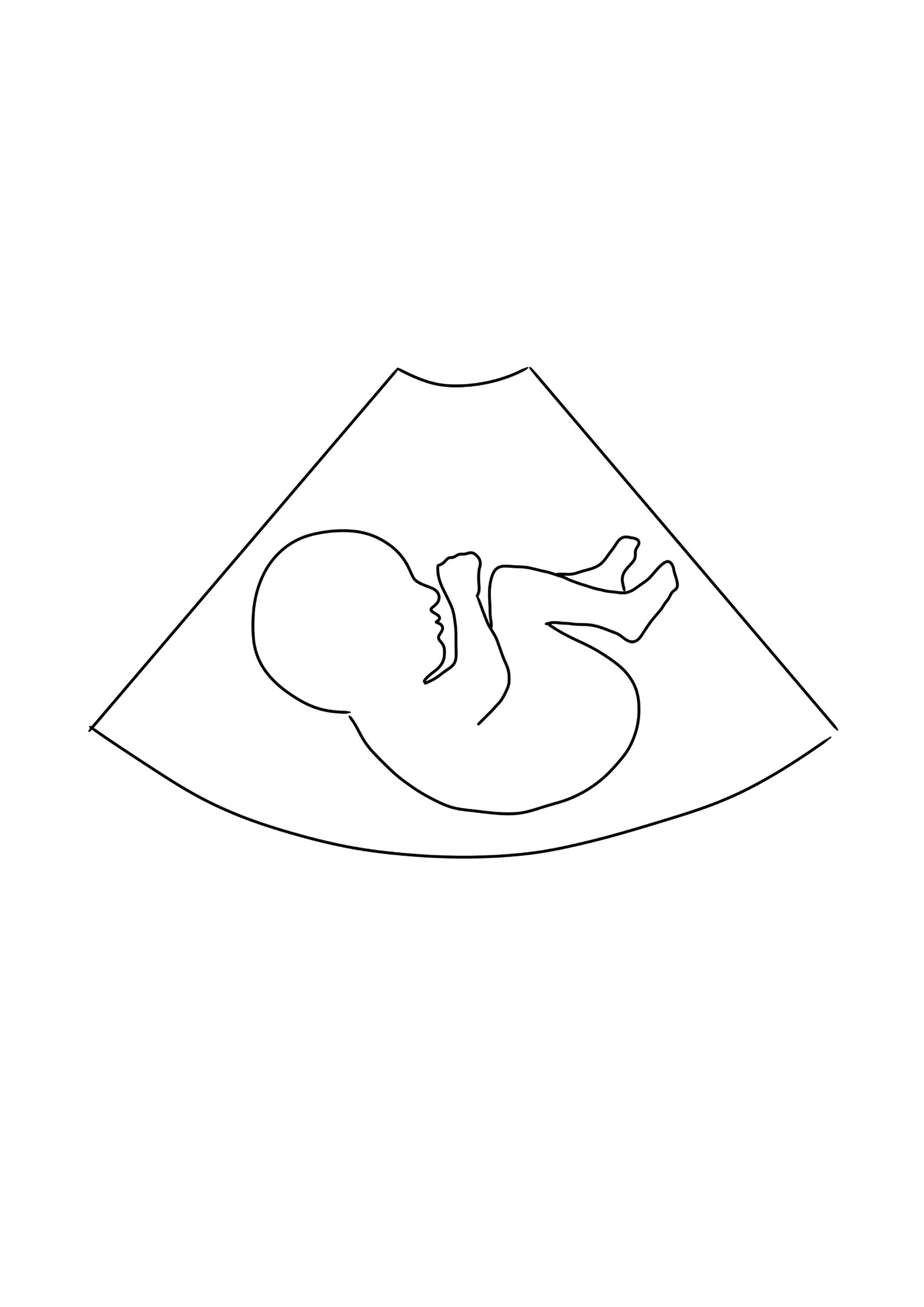 PRINTABLE Baby Ultrasound Poster Pregnant Line Art Pdf - Etsy