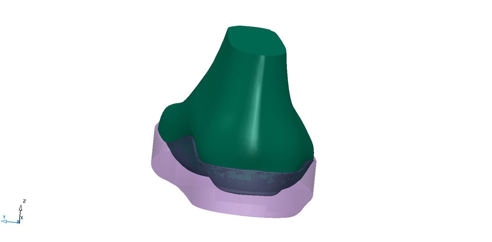 Digital 3d shoe last insole children ergonomic orthotic sole | Etsy