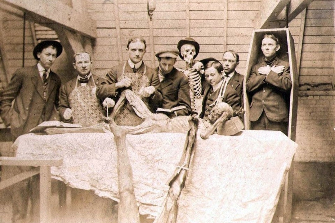 Cadaver Medical Doctor Dead Man Autopsy Photo Scary Creepy Cemetary ...