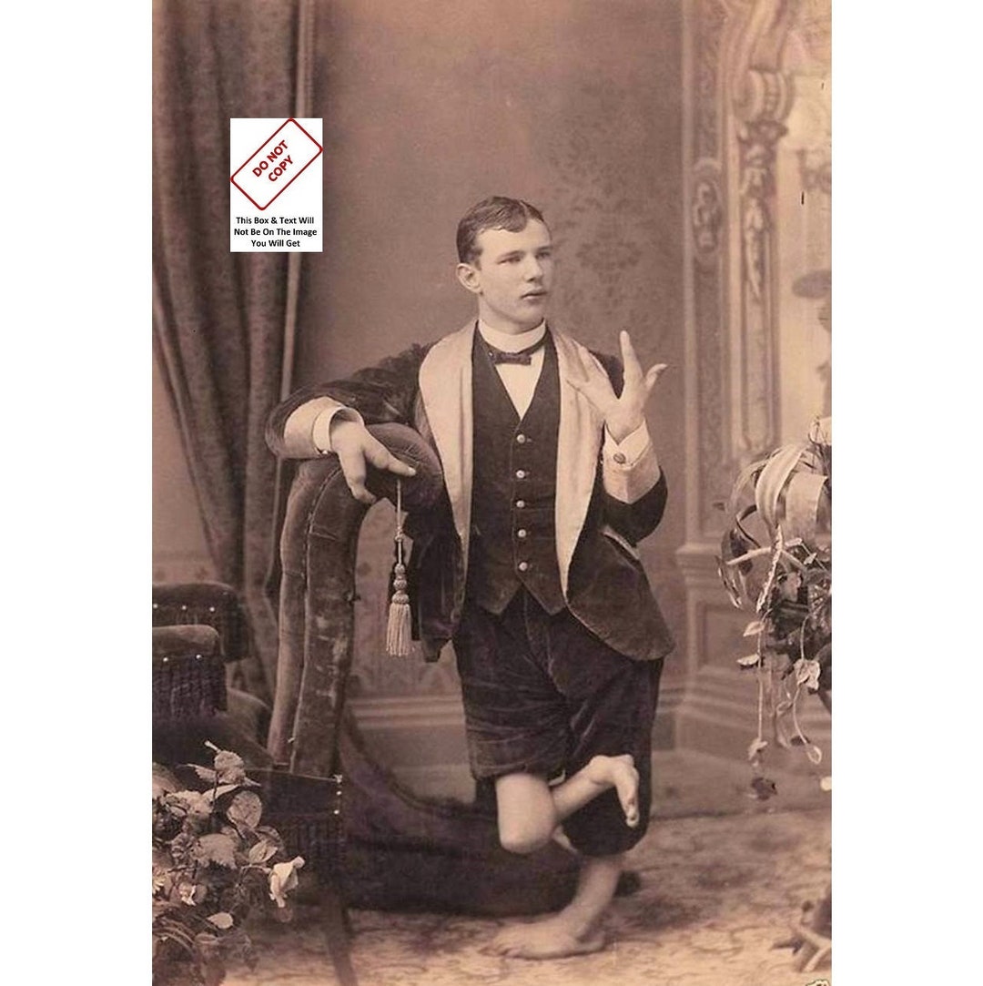 Creepy Lobster Boy Scary Sideshow Circus Freaky Child Strange Side Show ...