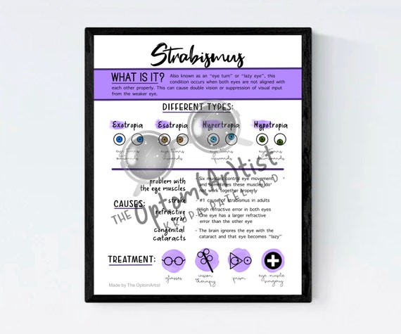 Strabismus Poster Lazy Eye Poster Optometry Poster - Etsy