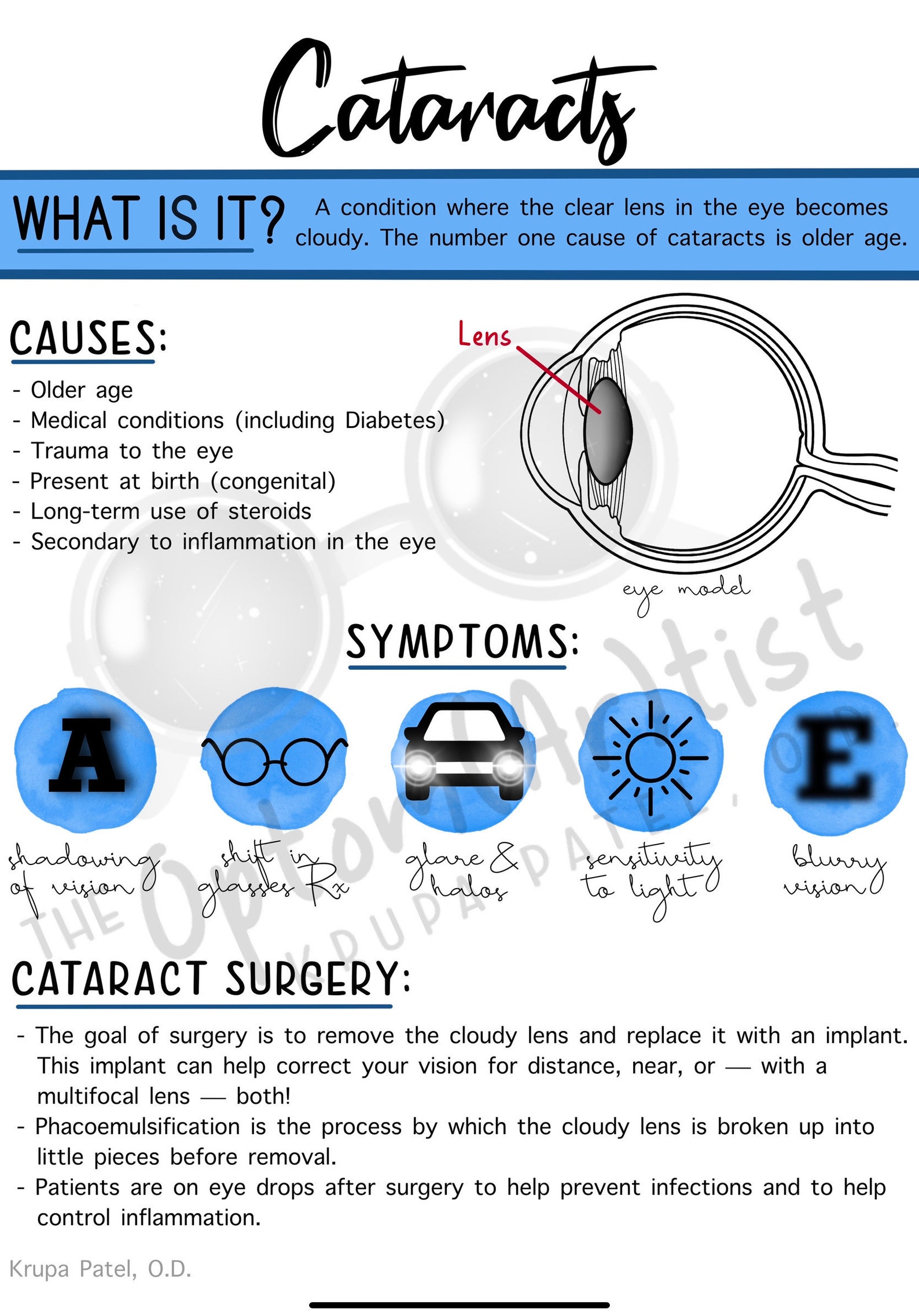 Cataracts Poster Optometry Poster Optometry Artwork - Etsy