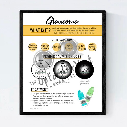 Cataracts Poster Optometry Poster Optometry Artwork | Etsy