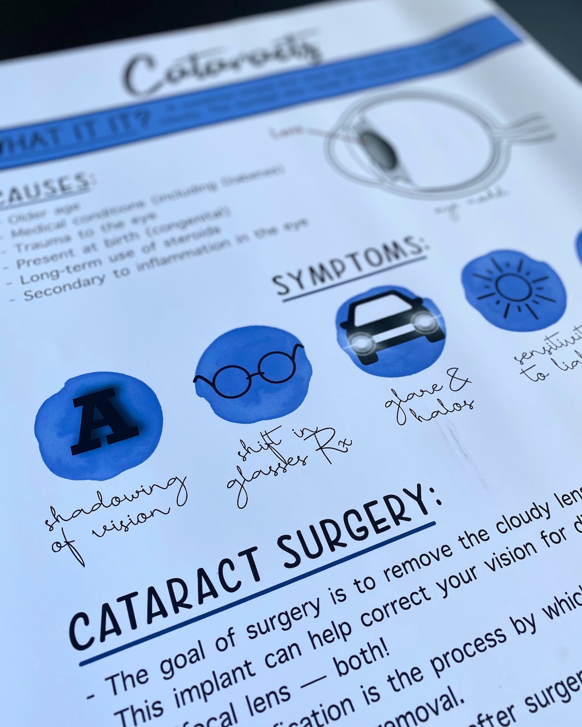 Cataracts Poster Optometry Poster Optometry Artwork - Etsy