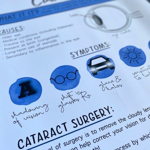 Cataracts Poster Optometry Poster Optometry Artwork | Etsy