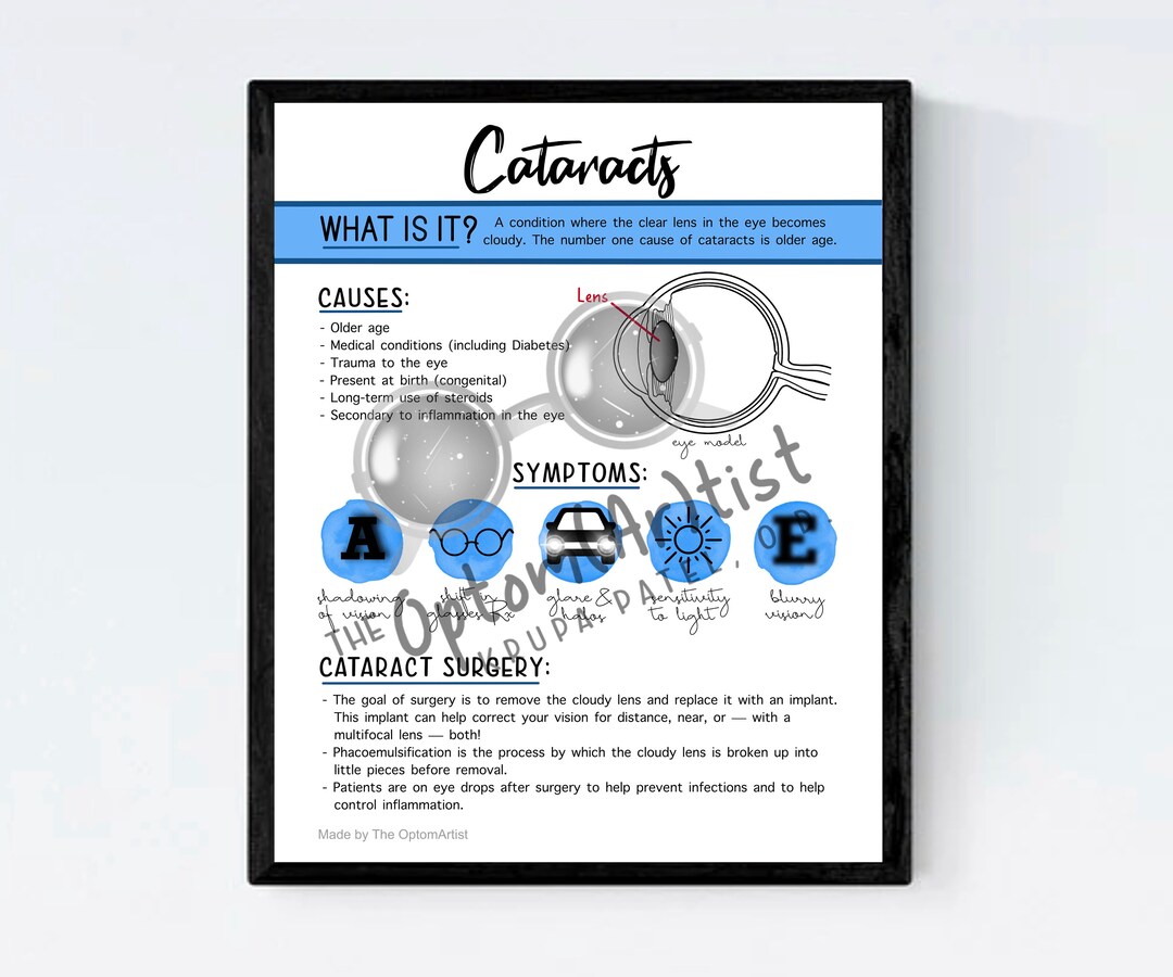 Cataracts Poster Optometry Poster Optometry Artwork - Etsy