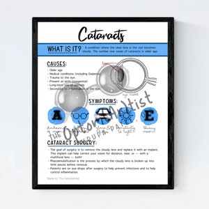 Cataracts Poster Optometry Poster Optometry Artwork | Etsy