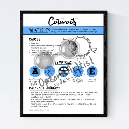 Cataracts Poster Optometry Poster Optometry Artwork | Etsy