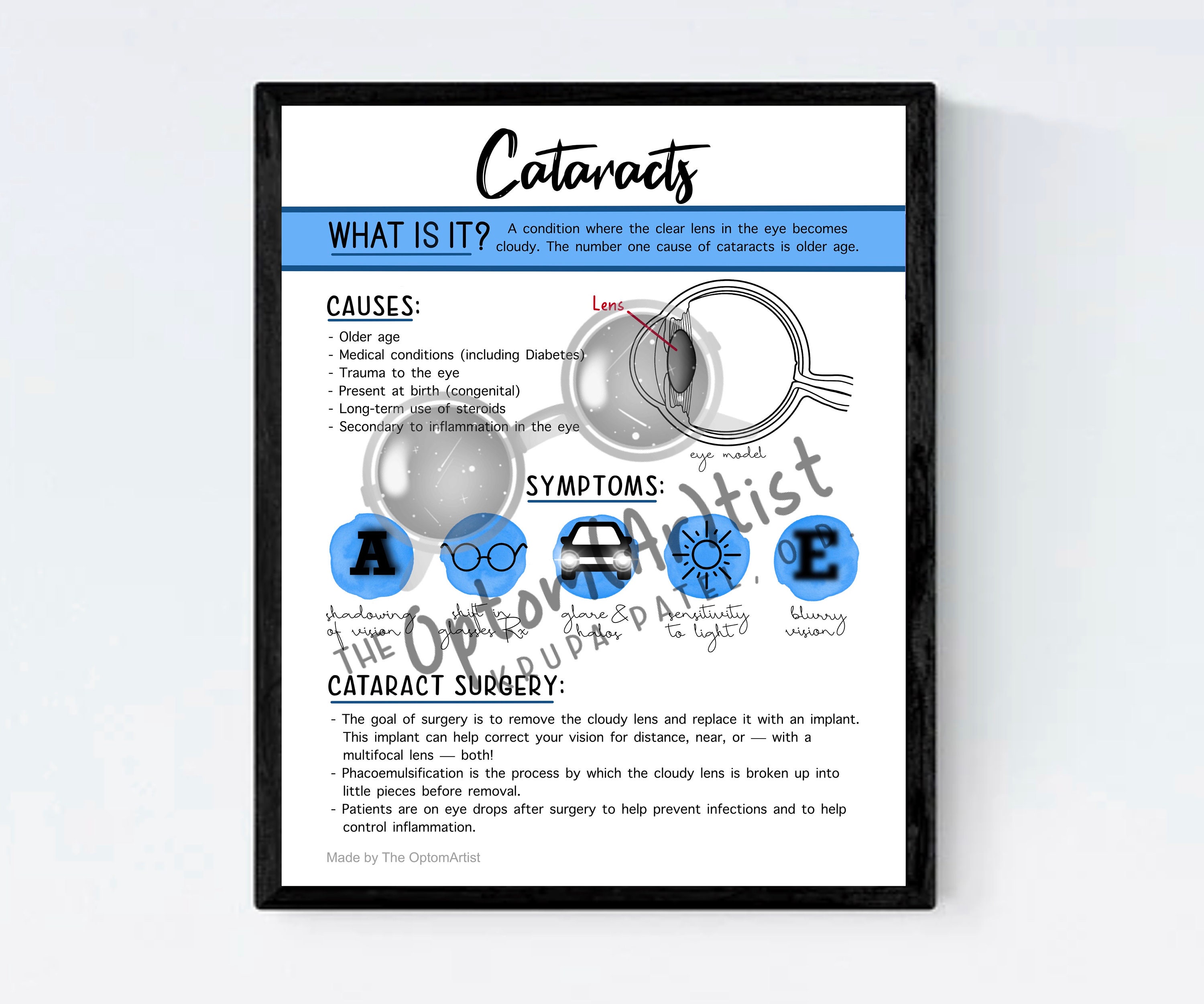 Cataracts Poster Optometry Poster Optometry Artwork - Etsy