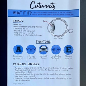 Cataracts Poster Optometry Poster Optometry Artwork - Etsy