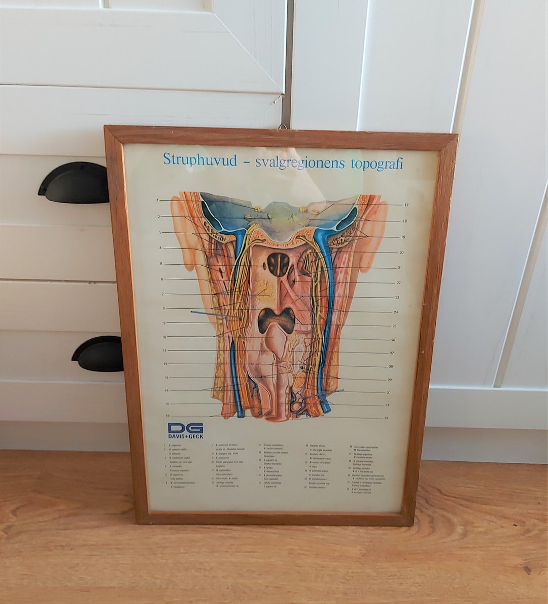 Vintage Laryngeal-pharyngeal Topography Poster , Vintage Anatomical ...