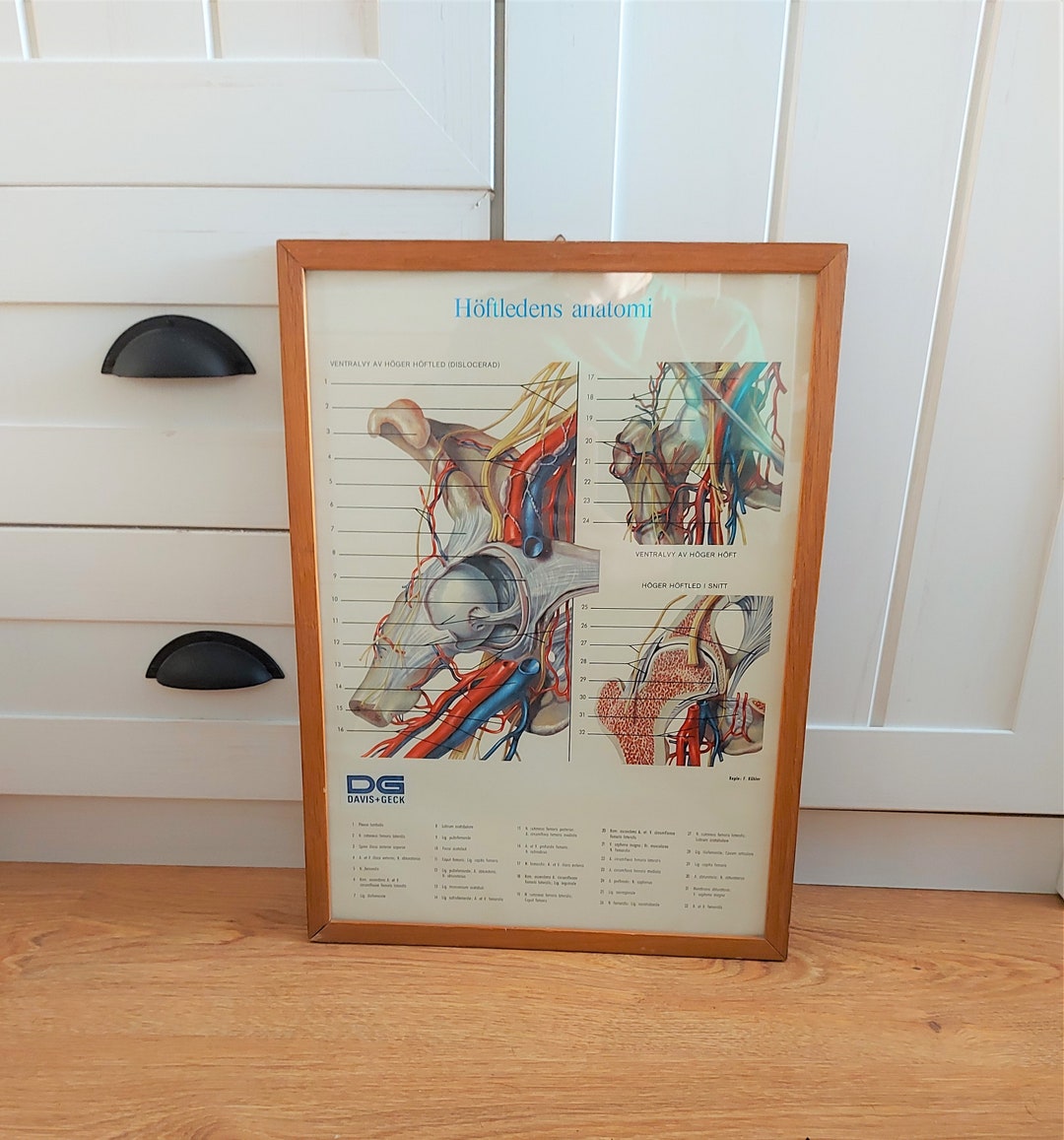 Vintage Anatomy of the Hip Joint Poster , Vintage Anatomical Manual ...