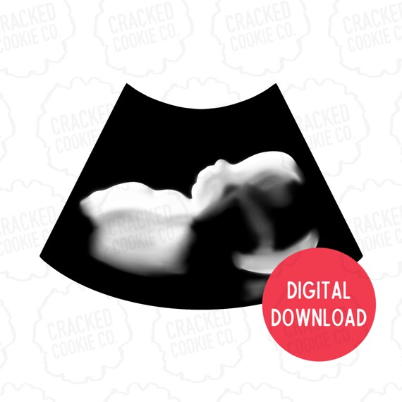Ultrasound Cookie Cutter STL File INSTANT - Etsy UK
