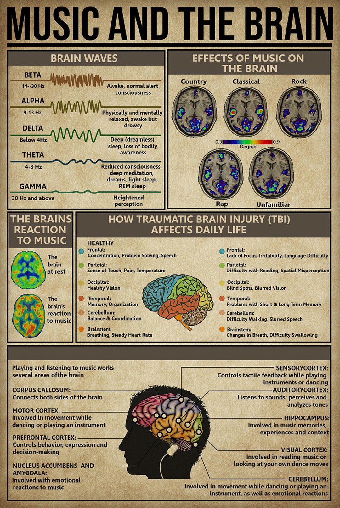 Music and the Brain Knowledge Poster, Vintage Poster, Effects of Music ...