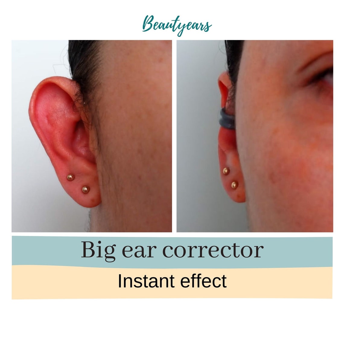 PROTRUDING EAR CORRECTOR | Etsy