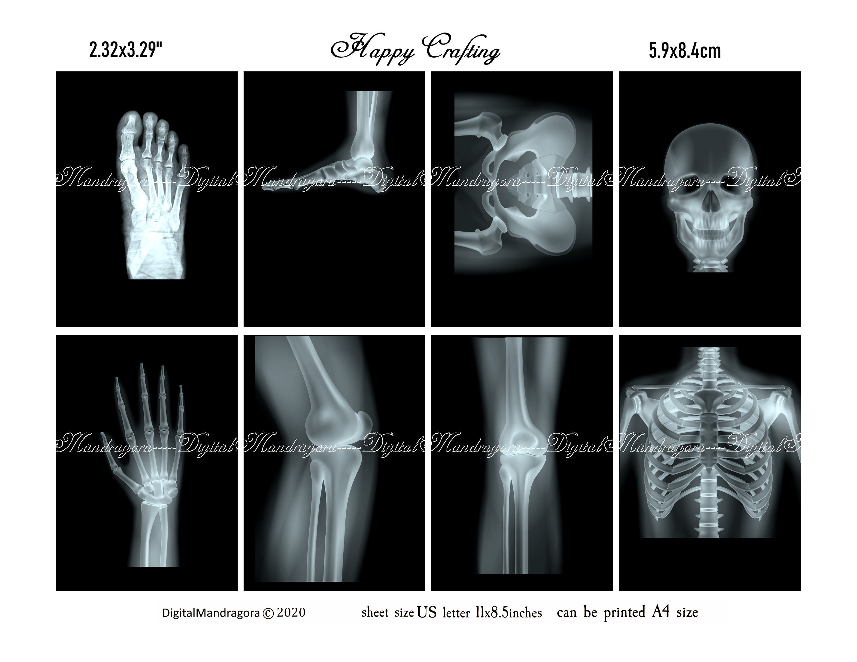 X-ray Slides With Tray Human Skeleton Vintage Medical - Etsy Canada