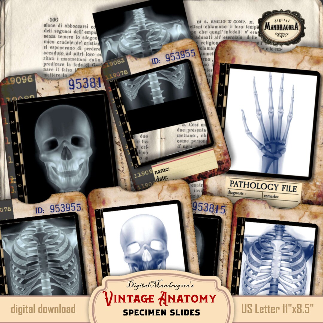 X-ray Slides With Tray, Human Skeleton, Vintage Medical Pathology Cards ...