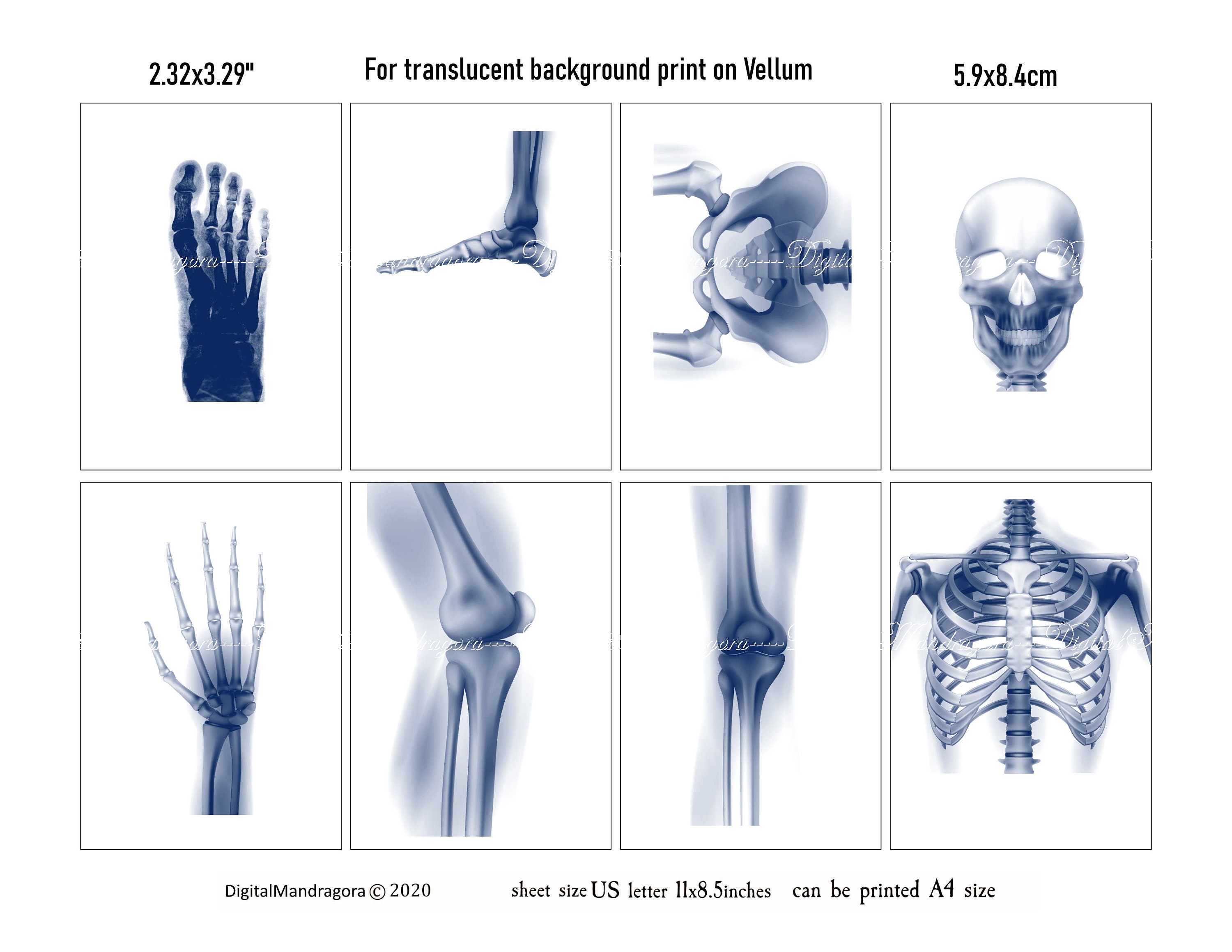 Vintage X-ray Anatomy Slides: Human Skeleton Medical Pathology Cards ...
