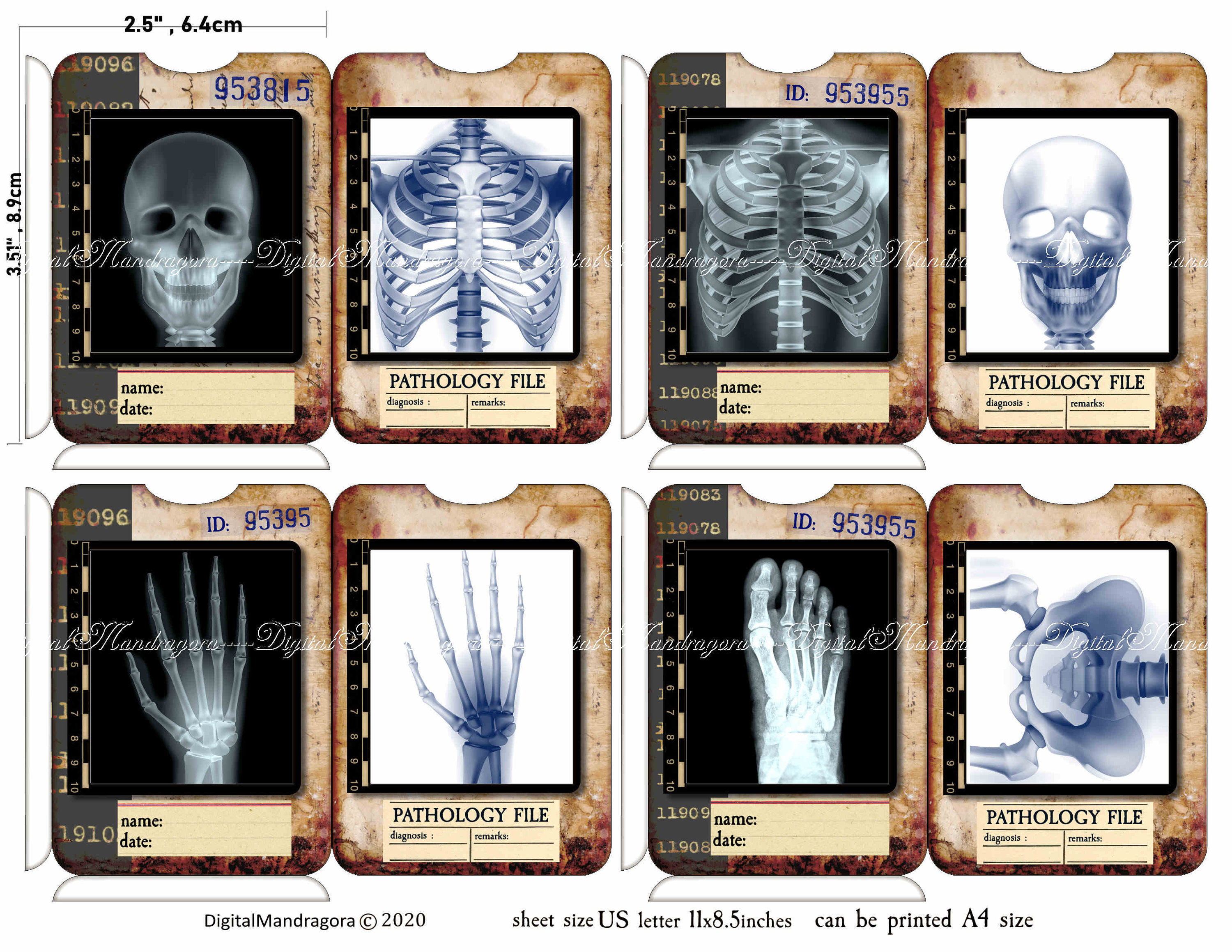 X-ray Slides With Tray Human Skeleton Vintage Medical | Etsy