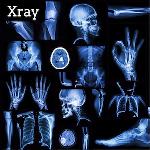 Radiology Scrub Cap. X-ray Surgical Cap, 100% Cotton. Radiologist ...