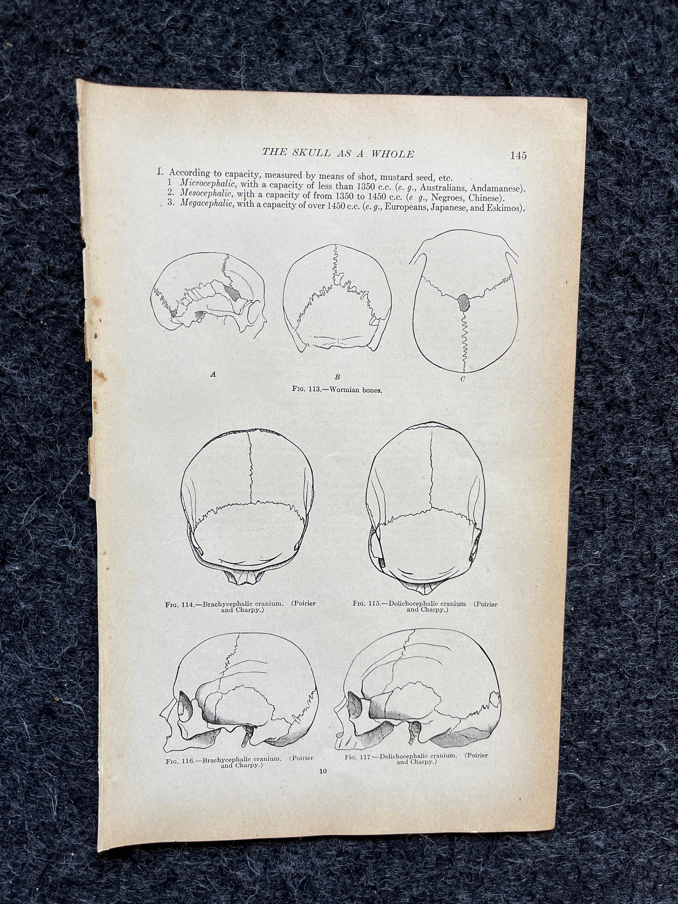 Original 1913 Anatomy Pages of Human Body, Anatomy Physiology Textbook ...