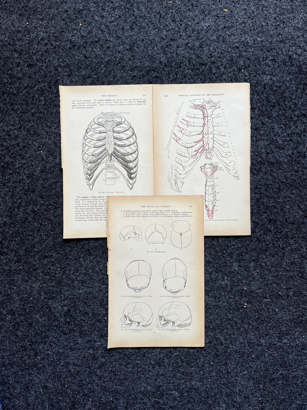 Original 1913 Anatomy Pages of Human Body, Anatomy Physiology Textbook ...