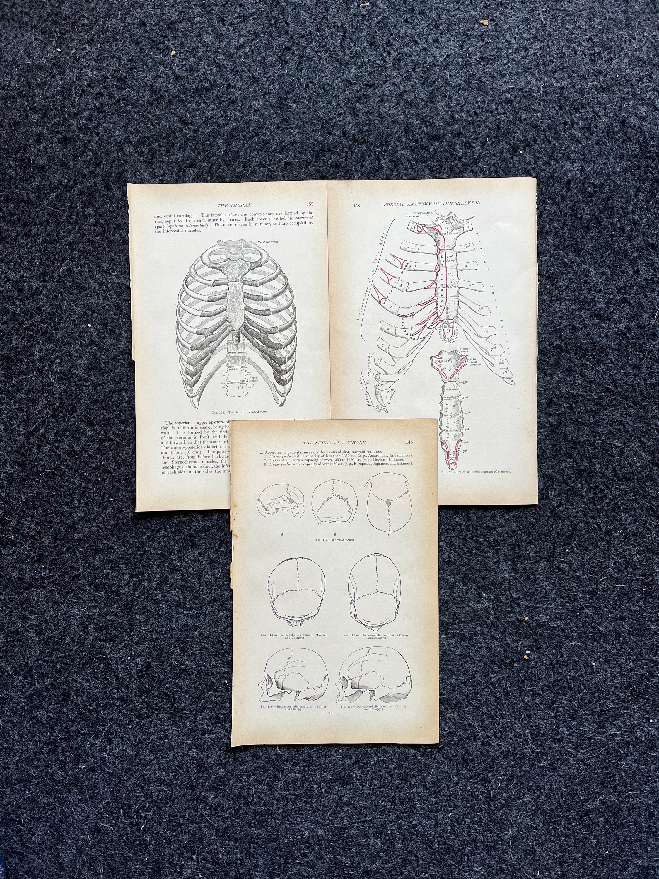 Original 1913 Anatomy Pages of Human Body, Anatomy Physiology Textbook ...