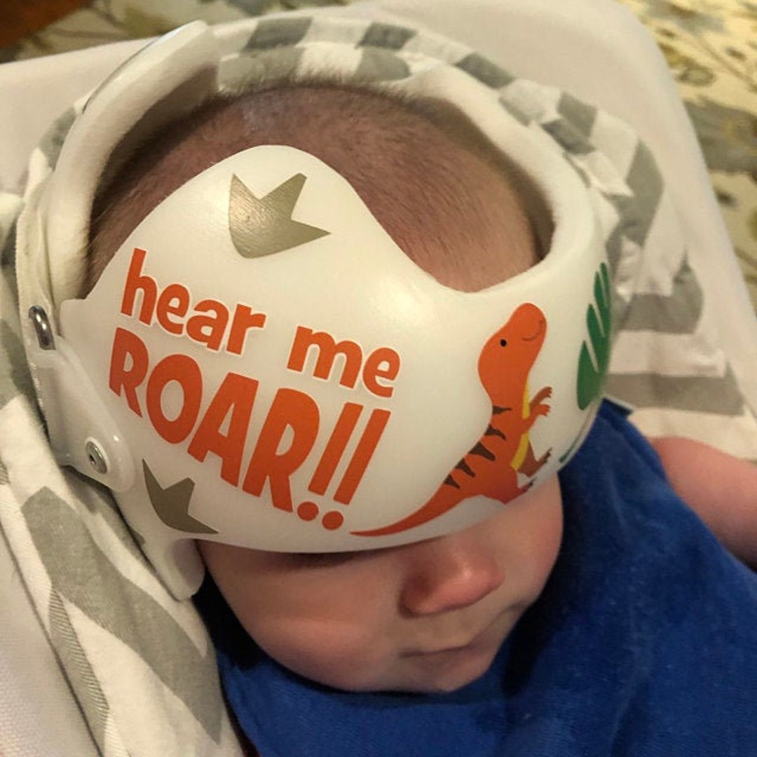 Personalized Baby Cranial Helmet Art, Doc Band, Star Band Decoration ...