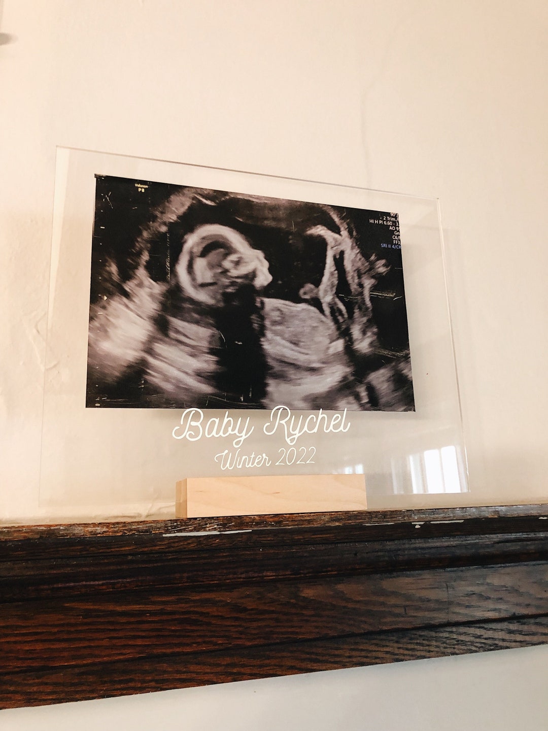 Custom Ultrasound Sign - Etsy