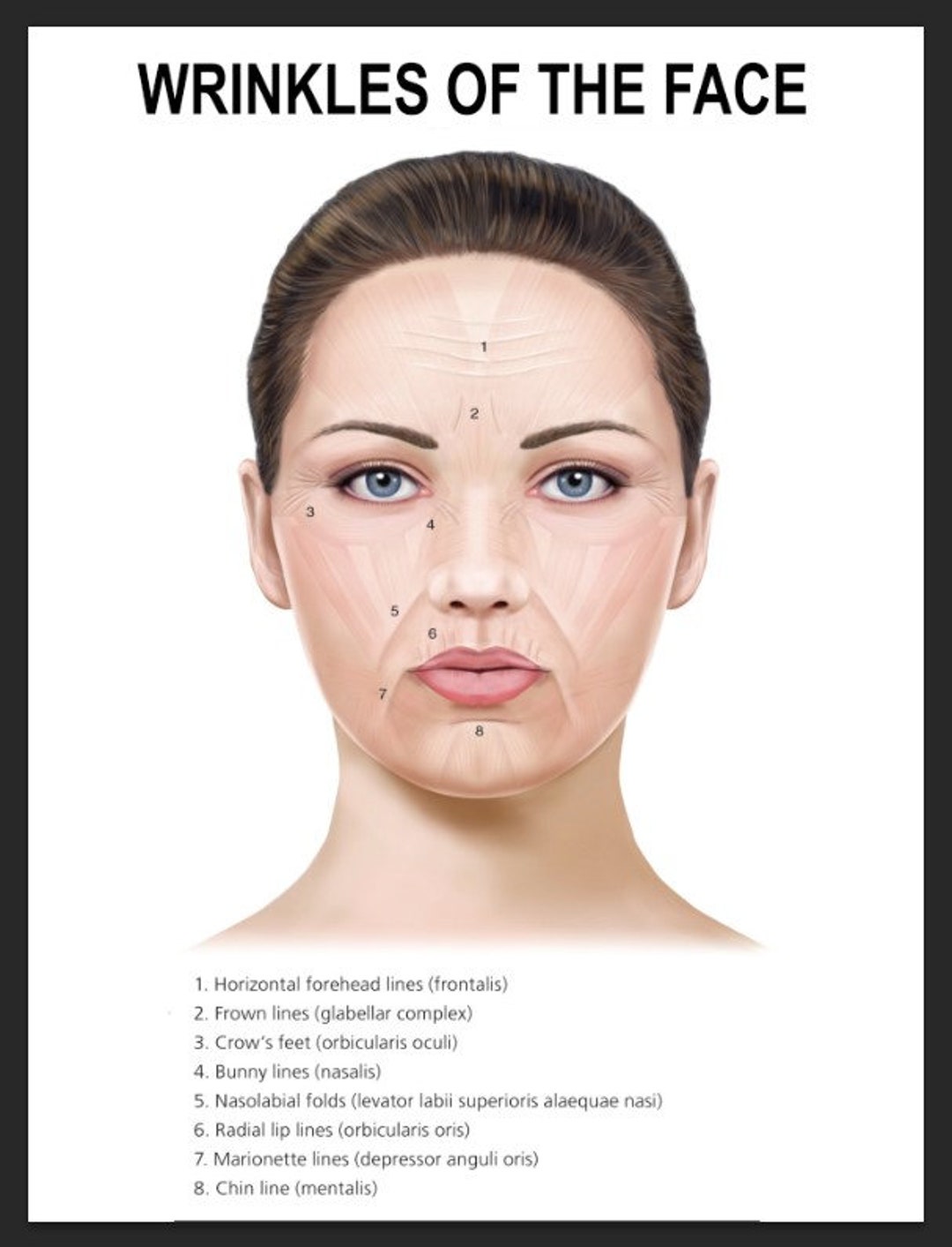 Wrinkles of the Face associated Muscle. Facial Mimetic Muscles Poster ...